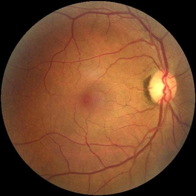 project6 Classification Dataset by Notebook