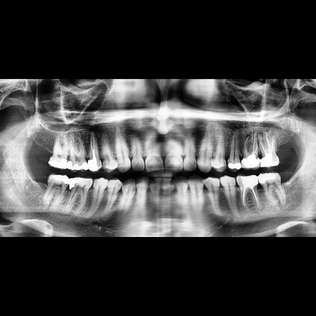 P Prueba 3 Object Detection Dataset By Cavities3