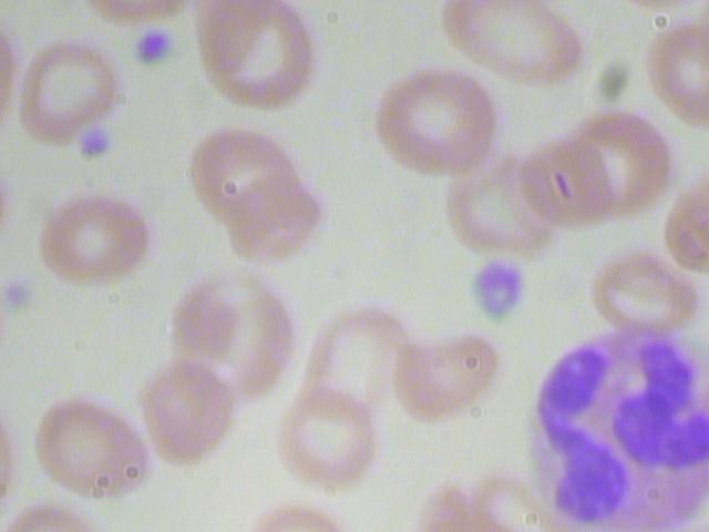 RBC Tracker Object Detection Dataset by Angelina Biomedical Workspace