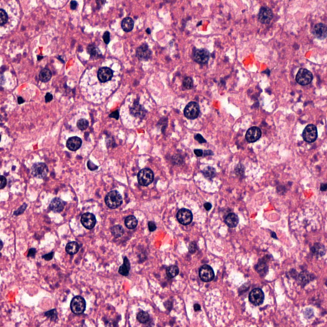 liver cell Object Detection Dataset and Pre-Trained Model by KyungHeeUniv