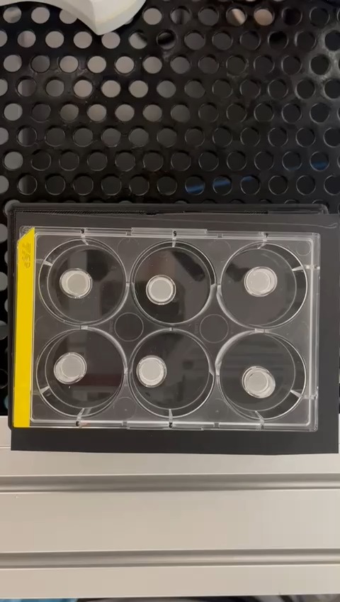 RHE-plate Instance Segmentation Model by PhD Dalia