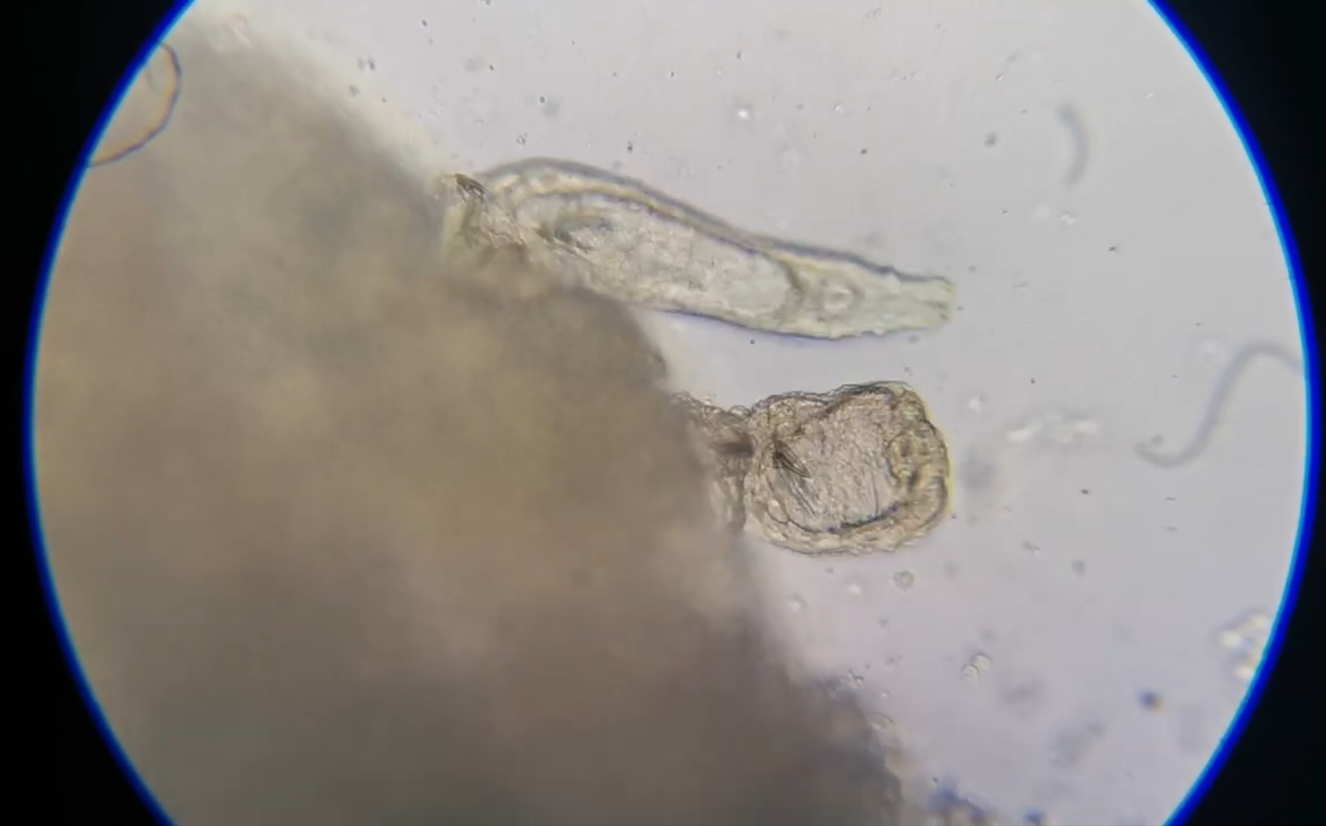 fish disease Object Detection Model by CircuitZone