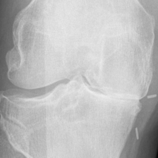 beh (beh-iphah) - Roboflow Universe