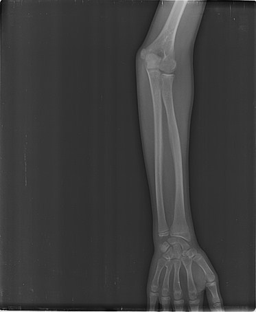 tryy Object Detection Dataset and Pre-Trained Model by try