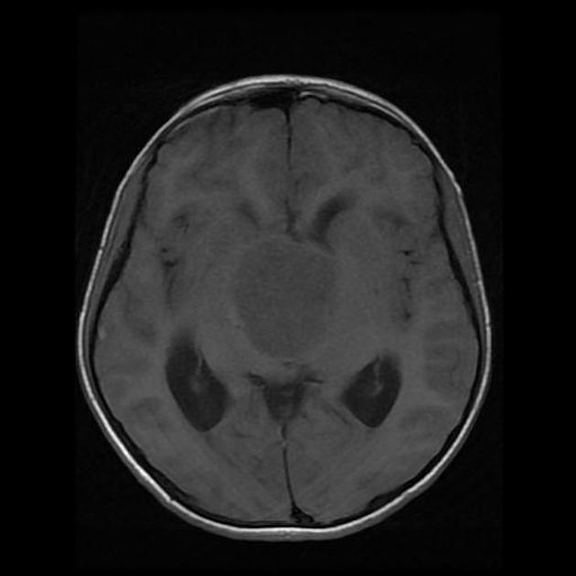 Brain Tumor MRI Classifications Classification Dataset by dl