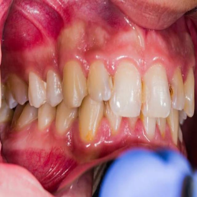 Diagnosis Gigi Object Detection Dataset and Pre-Trained Model by Yoga