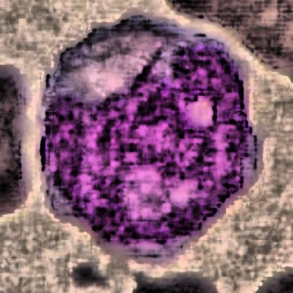 BCCD Object Detection Model by Workspace1