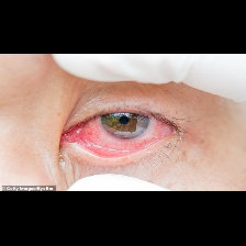 Eye_Data Instance Segmentation Model by EyesDataset