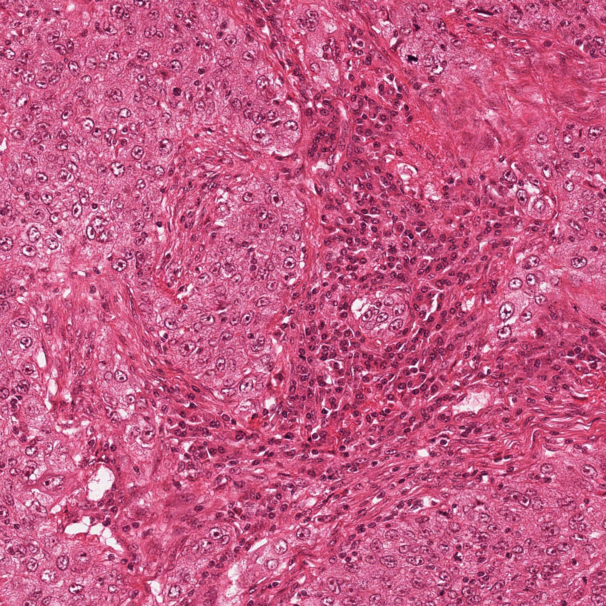 Mitosis Dataset Object Detection Dataset By Mitosis