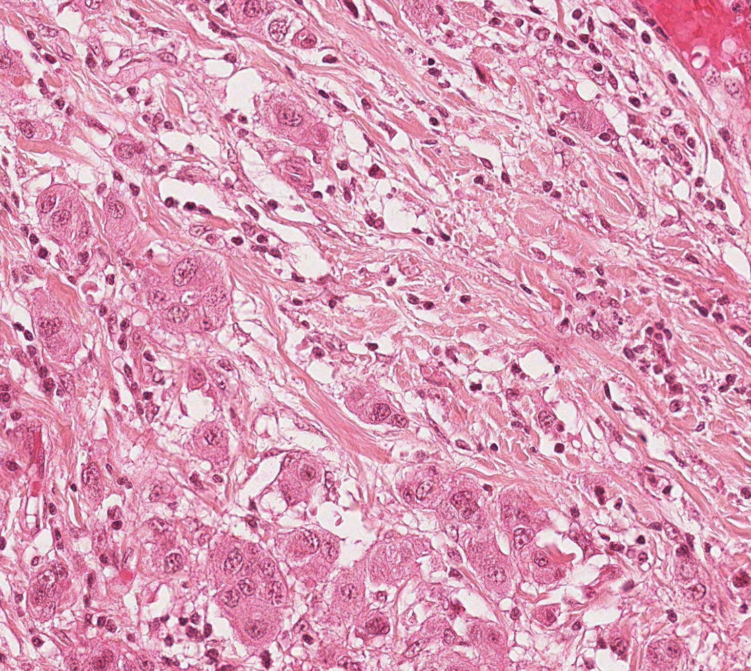 A07-3 Object Detection Dataset by Mitosis