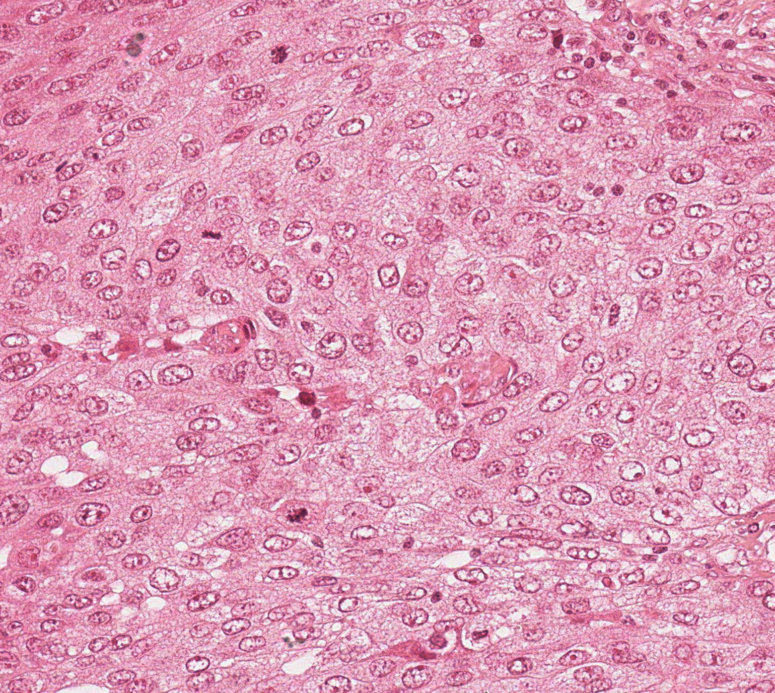 A04 2 Object Detection Model By Mitosis