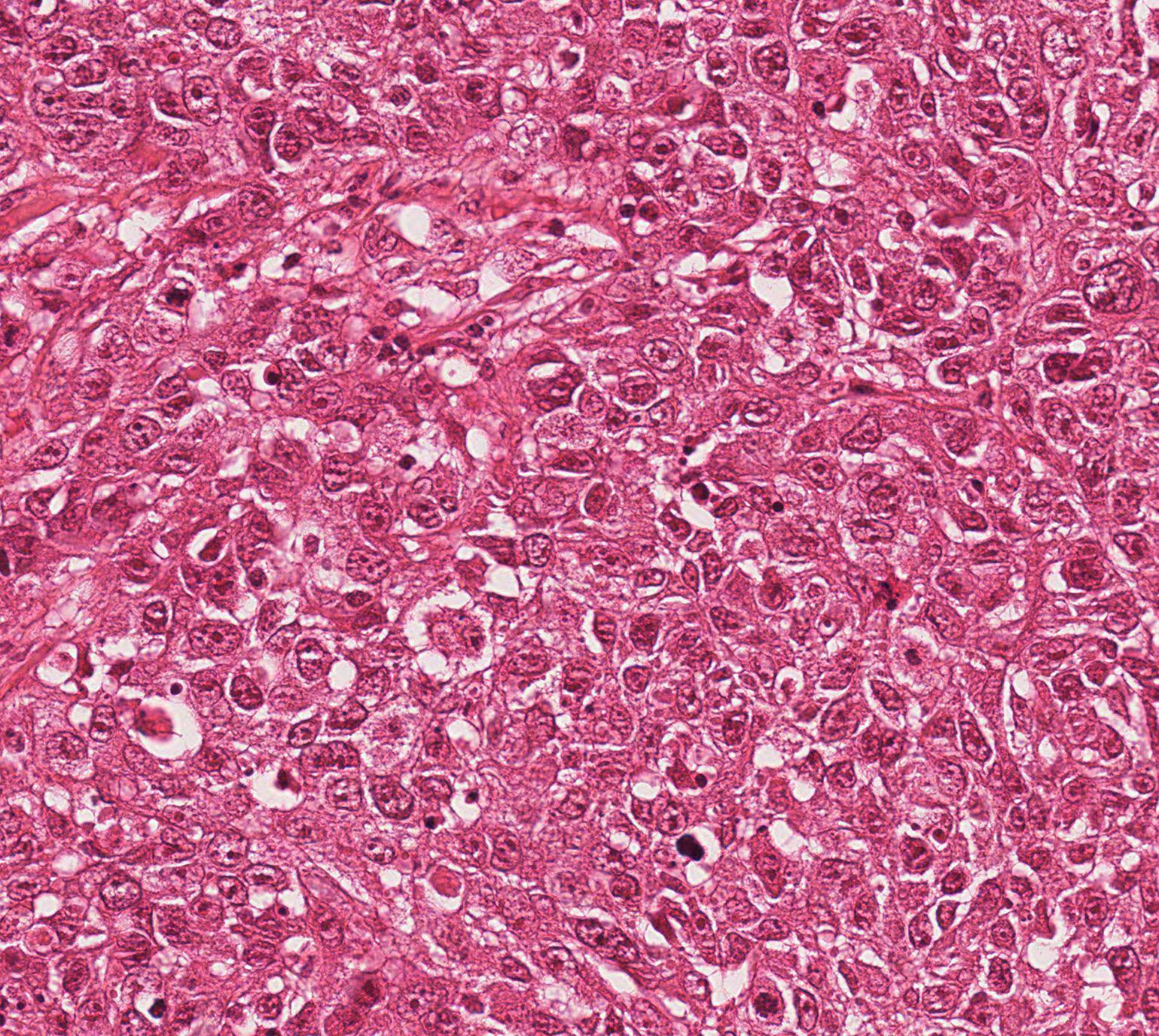 A11 2 Object Detection Dataset And Pre Trained Model By Mitosis