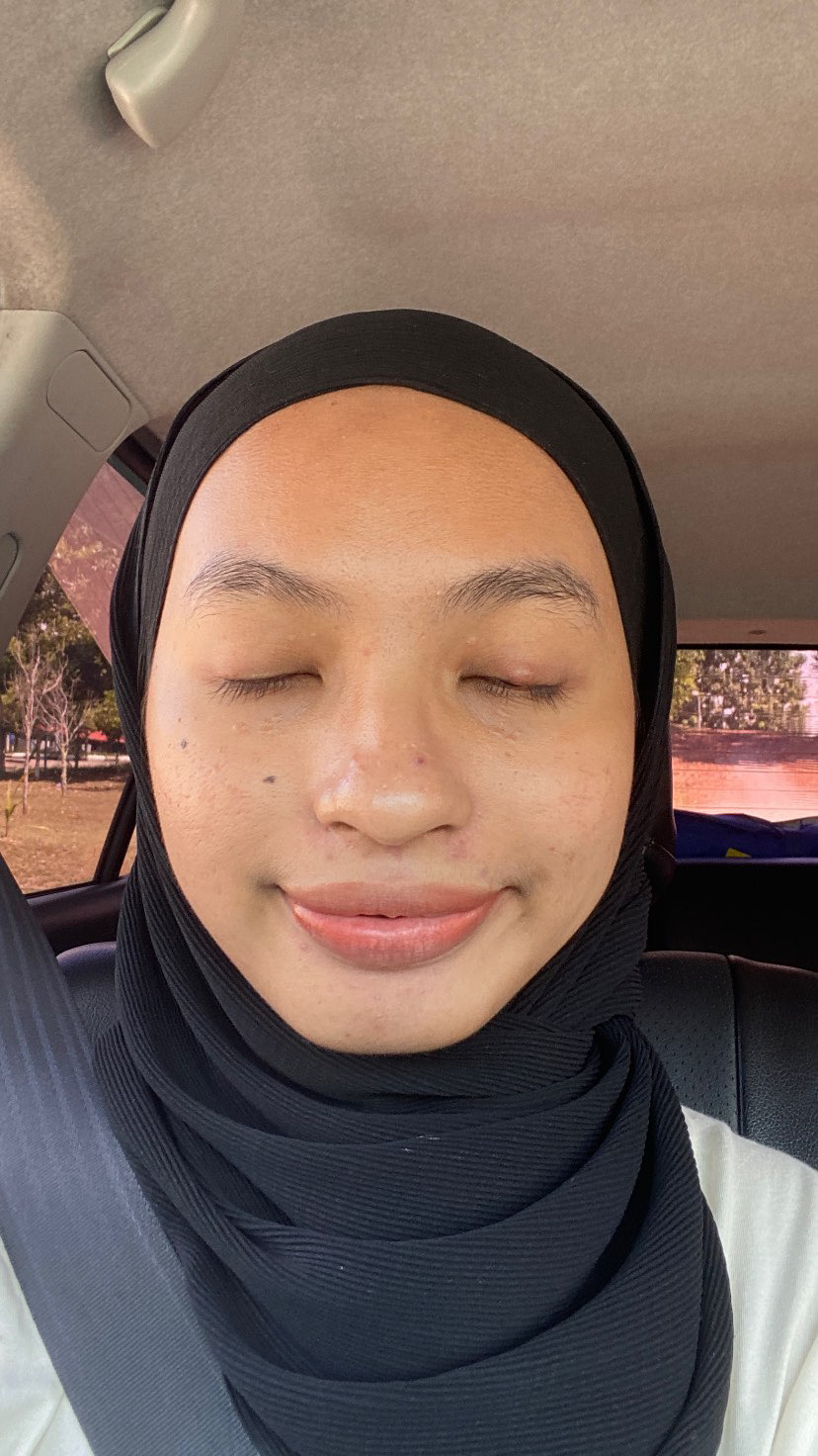 Lip Shape Instance Segmentation Model by fyp