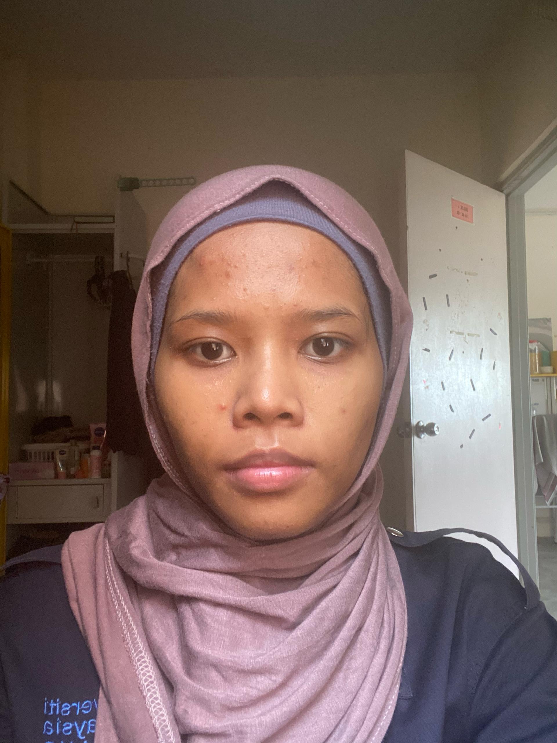 Facial Structure Object Detection Dataset And Pre Trained Model By Fyp