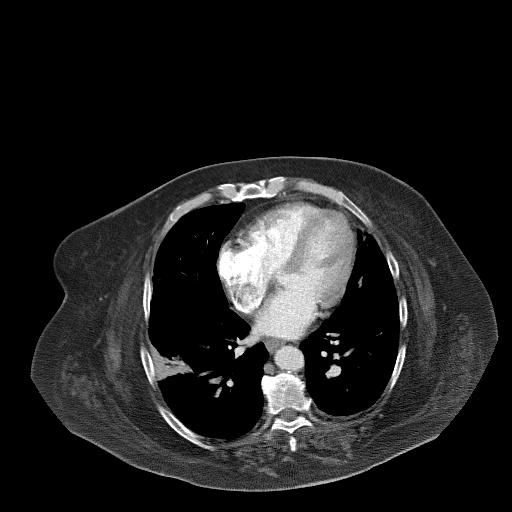 Lungs Detection Object Detection Dataset by Viltu Jujhajiya
