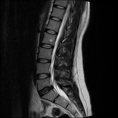 LabelImage Instance Segmentation Dataset by Label