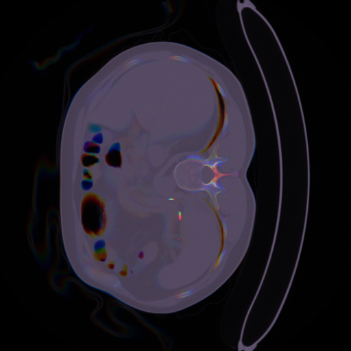 Lesion Detection Object Detection Dataset By Lesion