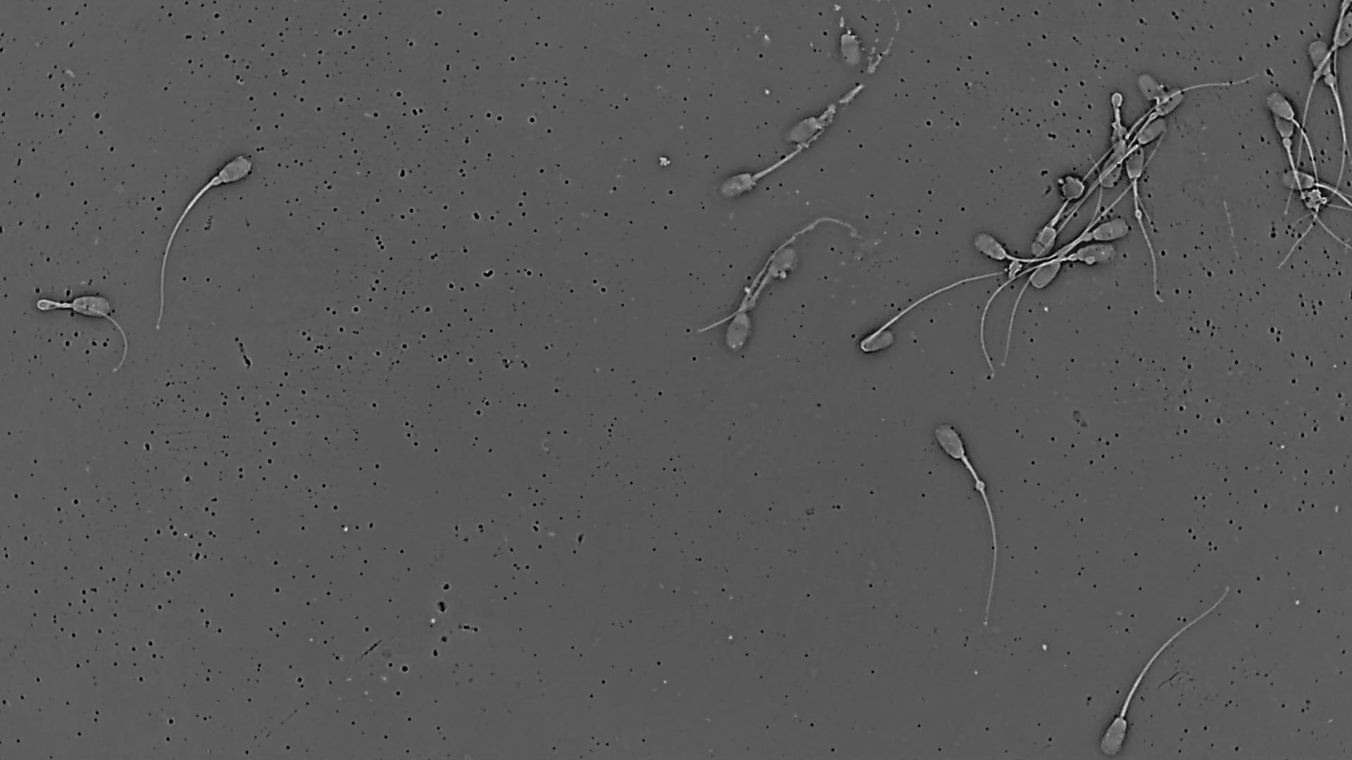 sperm_segmentation Object Detection Model by Gopi