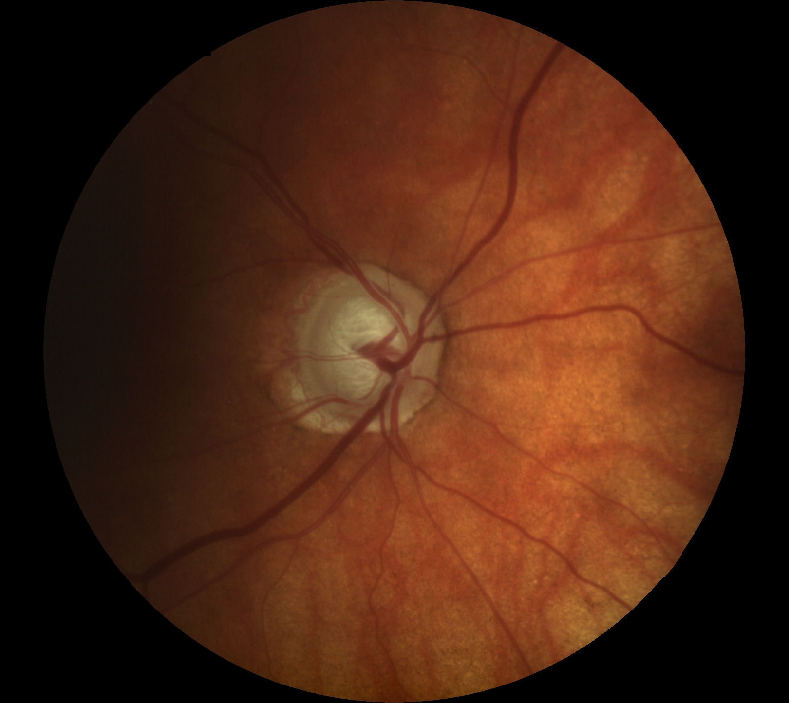 Central Retina Object Detection Dataset by university