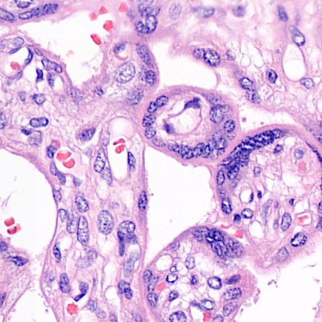 Tissue analysis - Roboflow Universe