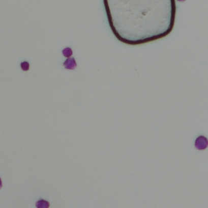 Pollen Detector v2 Object Detection Dataset and Pre-Trained Model by Pollen Identification