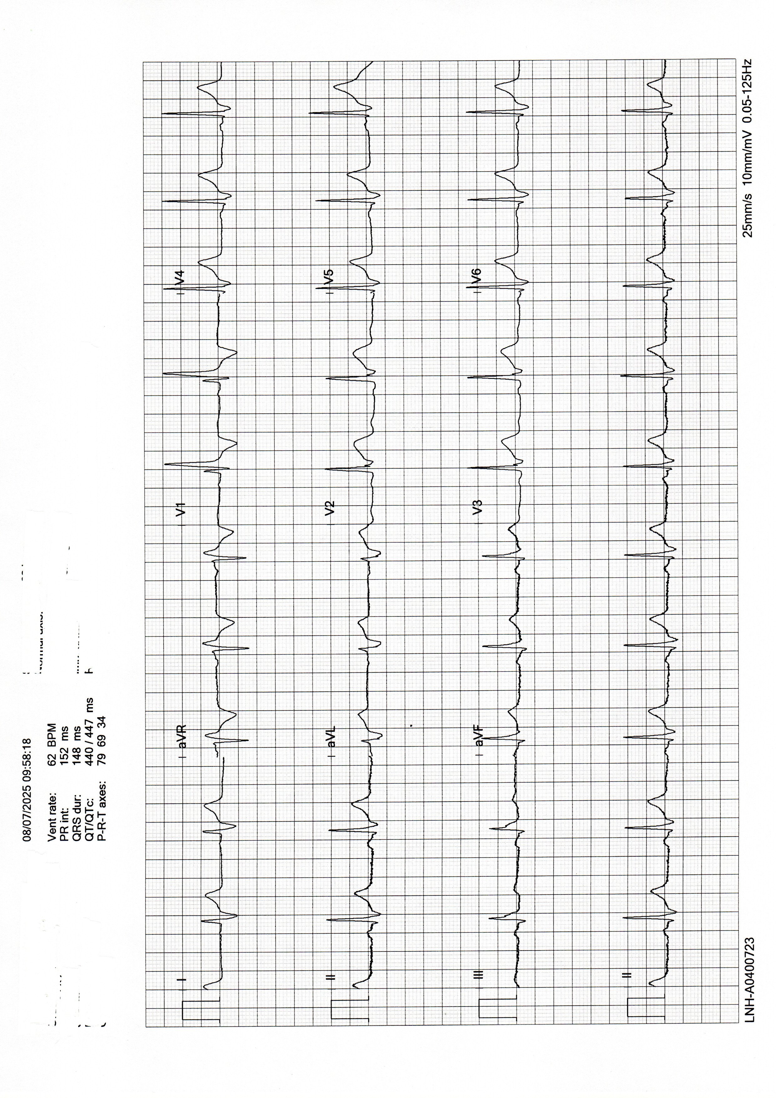 ECG Pattern Recognition - Roboflow Universe