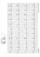 ECG Pattern Recognition - Roboflow Universe