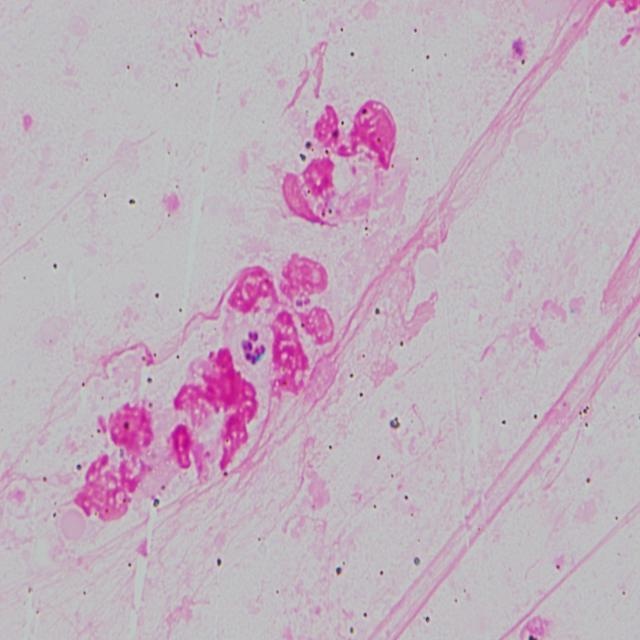 leuko_3c_4xf Object Detection Dataset by Leukocyte20241020