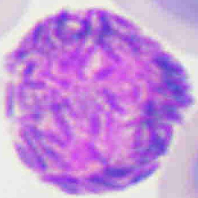 xstatic - Roboflow Universe