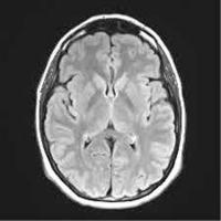 MLDL (mldl-dmwkl) - Roboflow Universe