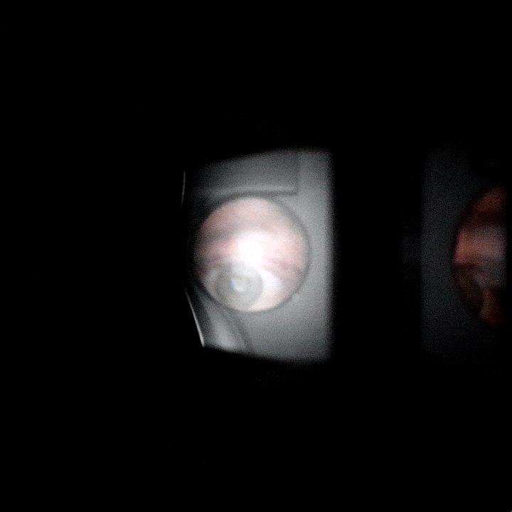 Pupil Object Detection Dataset And Pre Trained Model By Eyetracker