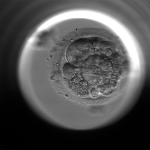 Oocyte Object Detection Dataset and Pre-Trained Model by 360digi TMG