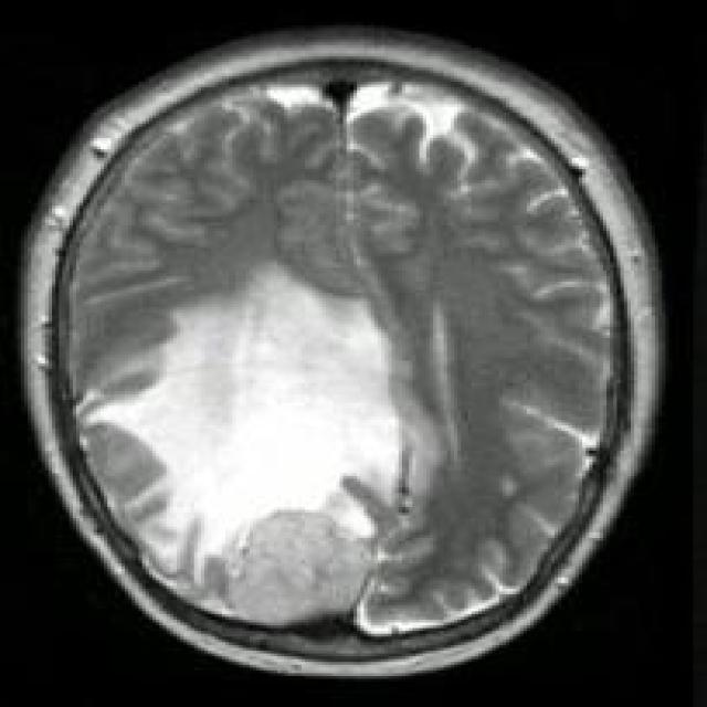 brain Instance Segmentation Model by projectsdatasets