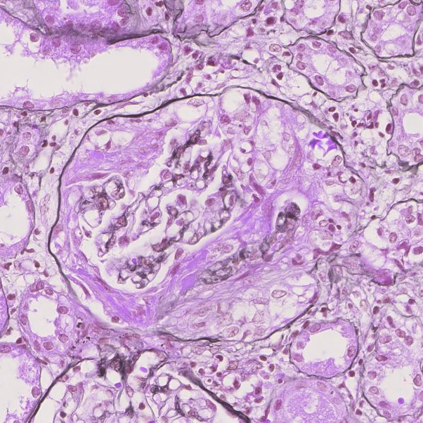 Glom Classif Classification Dataset by Object detection Yolov5