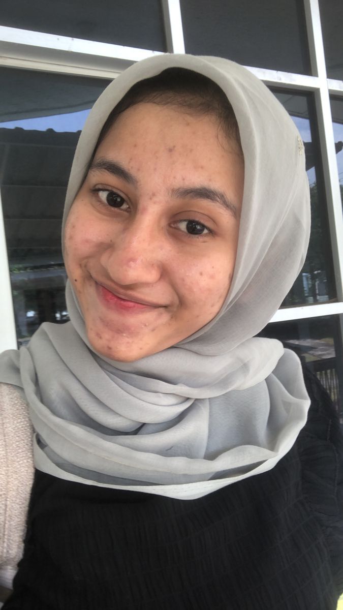Skin Health Classification Classification Model by Swati P