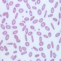 Deep Learning Computer Vision - Roboflow Universe