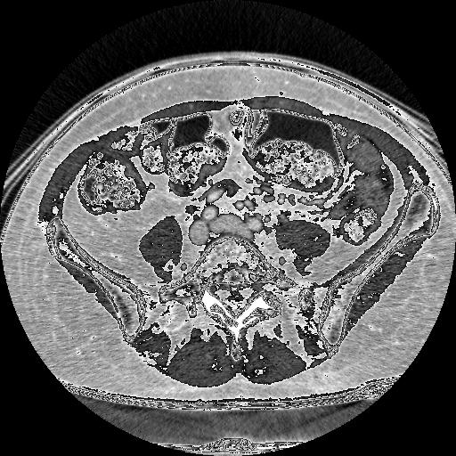 Liver Segmentation Project Object Detection Dataset And Pre Trained
