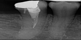 dental_bone Instance Segmentation Dataset by ImageSegment1