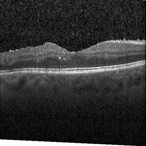 Glaucoma Detection Classification Dataset (v1, 2024-02-18 10:46pm) by ... Glaucoma Detection Classification Dataset (v1, 2024-02-18 10:46pm) by ...