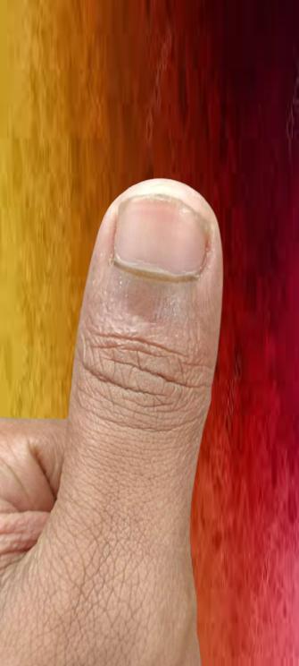 cam thumb Object Detection Dataset by Fingerdetection