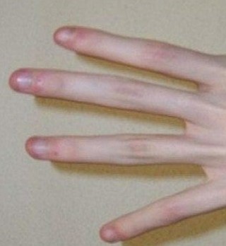 zoom_fingers Object Detection Dataset and Pre-Trained Model by Fingerdetection