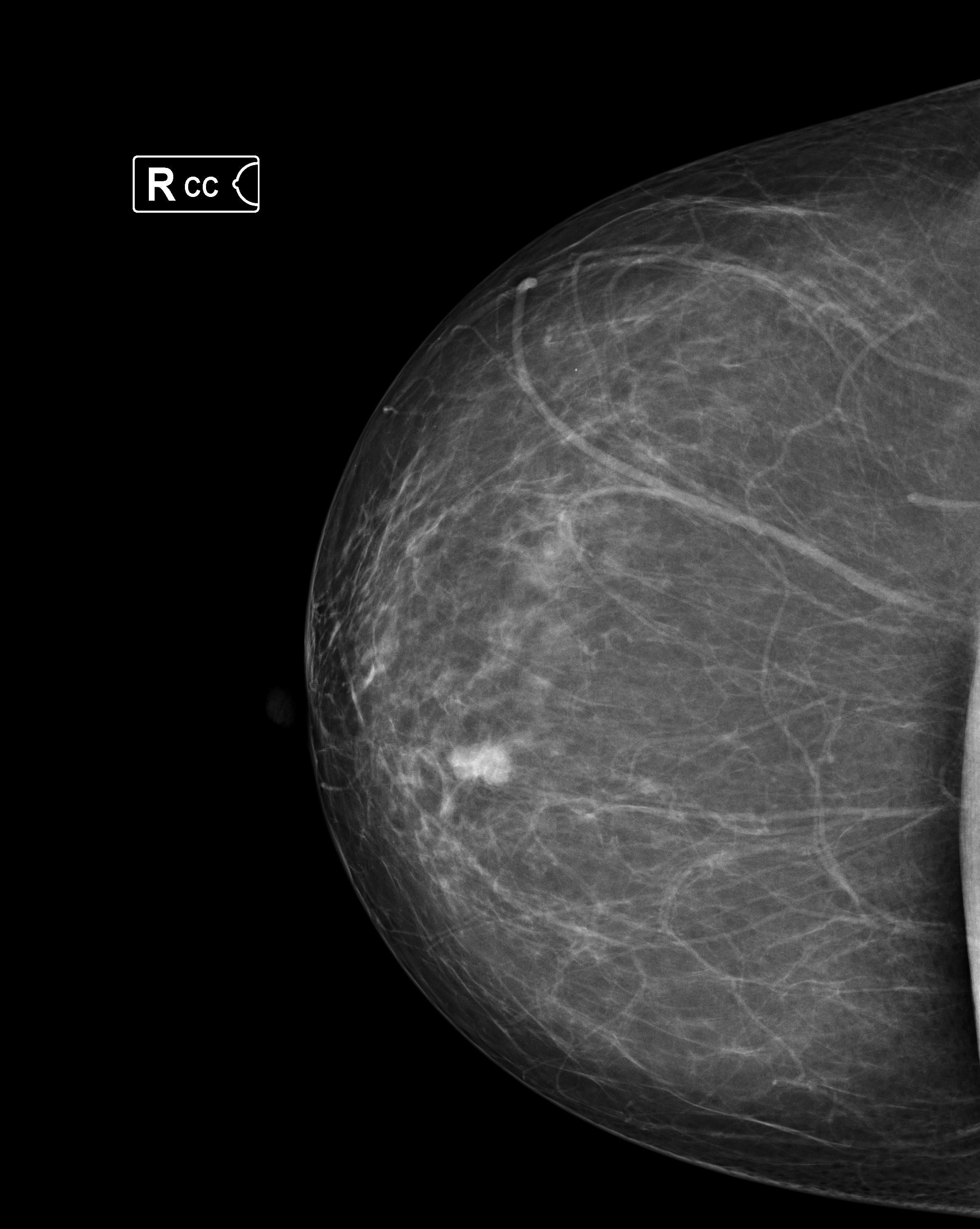 MT Object Detection Dataset by MasterThesis