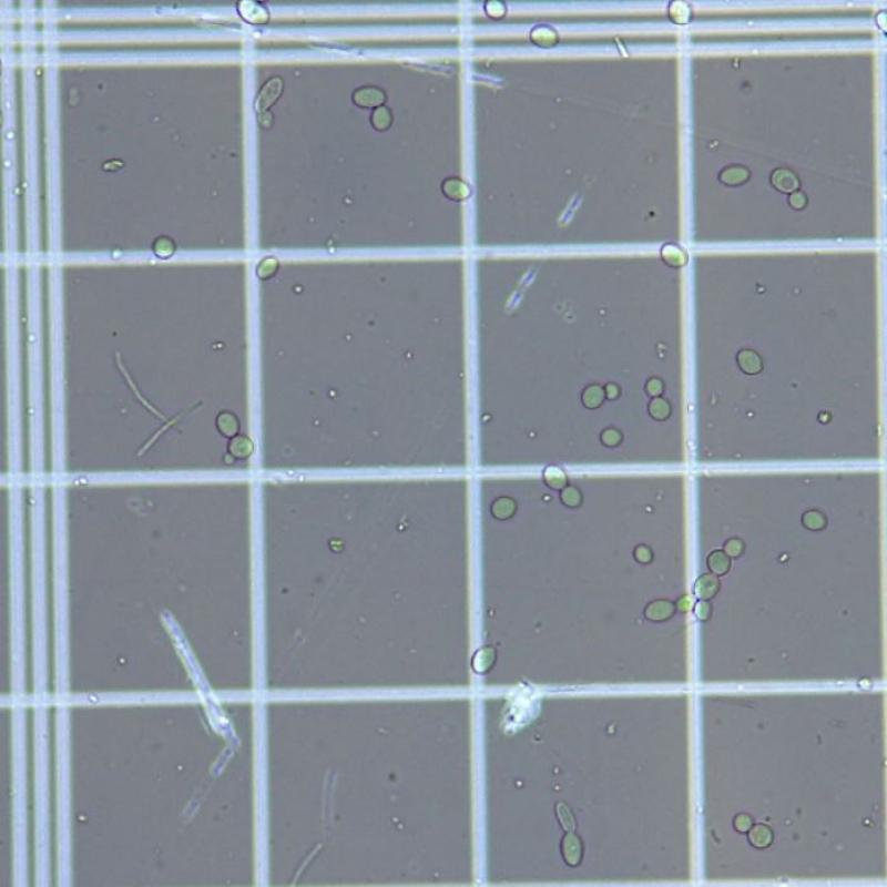 Yeast Cells Detection Object Detection Dataset V1 2024 10 03 3 55am