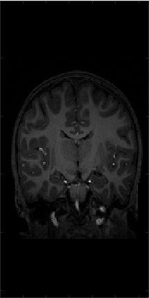 SMRI - Roboflow Universe