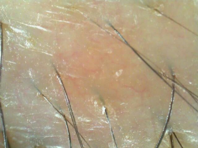 hair_thickness Dataset Object Detection Model by Hair