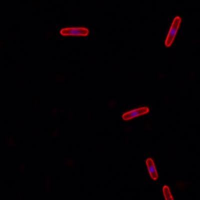 bacteria detection Object Detection Model by project3
