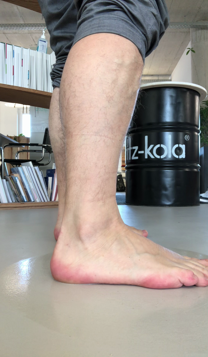 barefoot-pose-classifier Classification Dataset by Public