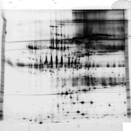 2d-gel-li-jiaxing Classification Dataset and Pre-Trained Model by 2d gel