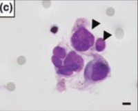 CTC AI - Roboflow Universe