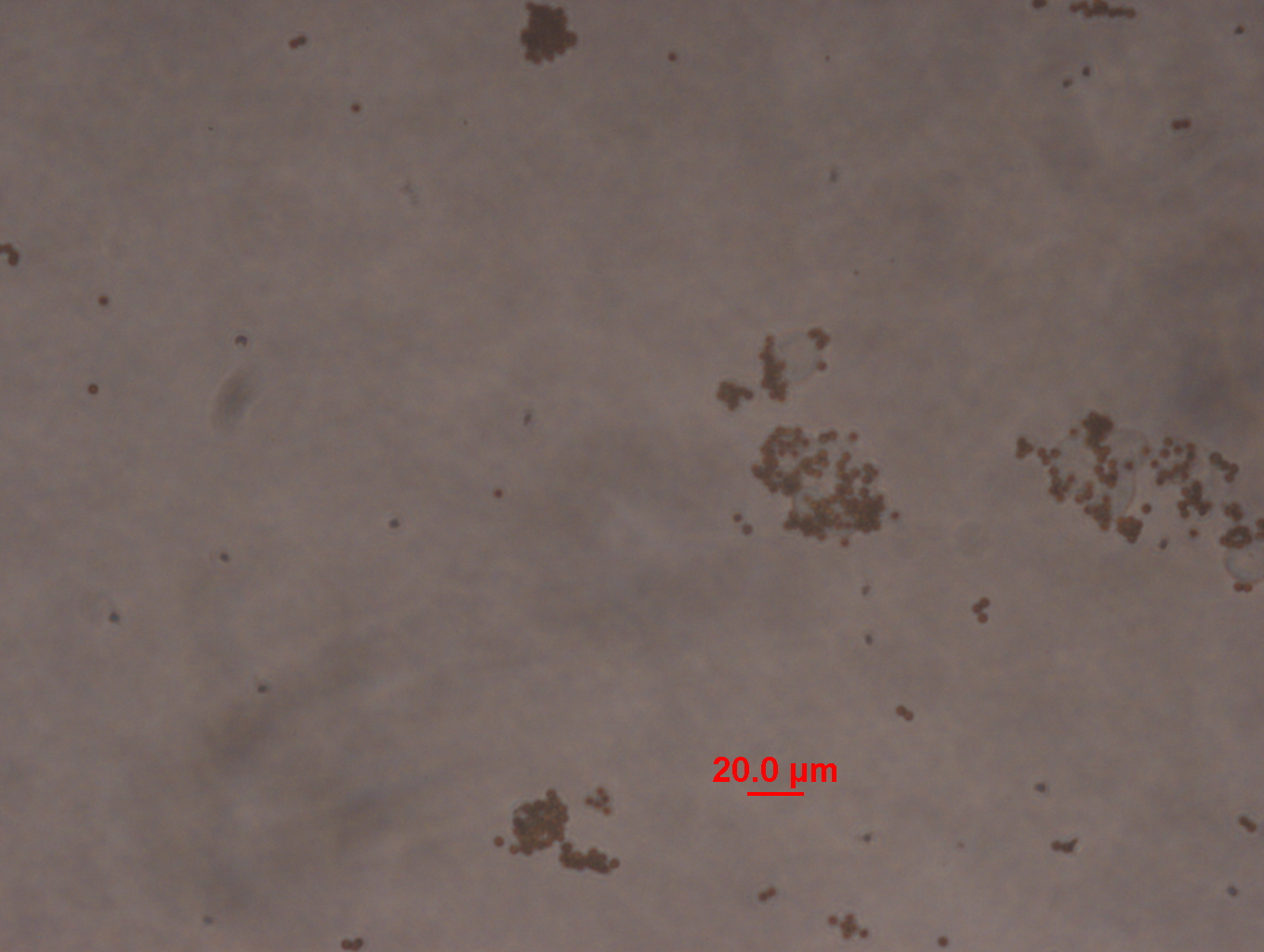 Cells_3um_filter Object Detection Dataset by Mems